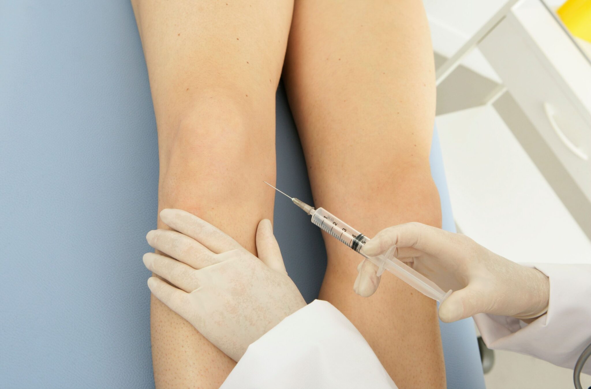 Infiltrations vraiment précises - Injection cortisone et arthrose genou
